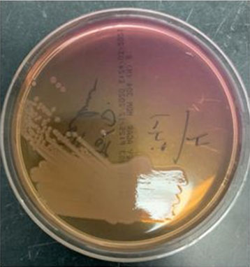 Aeromonas veronii co-infection eye and skin: Case report - Journal of ...